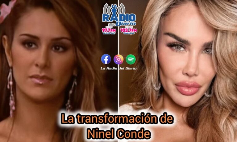 El antes y después de Ninel Conde: así luce con su nuevo color de ojos ...